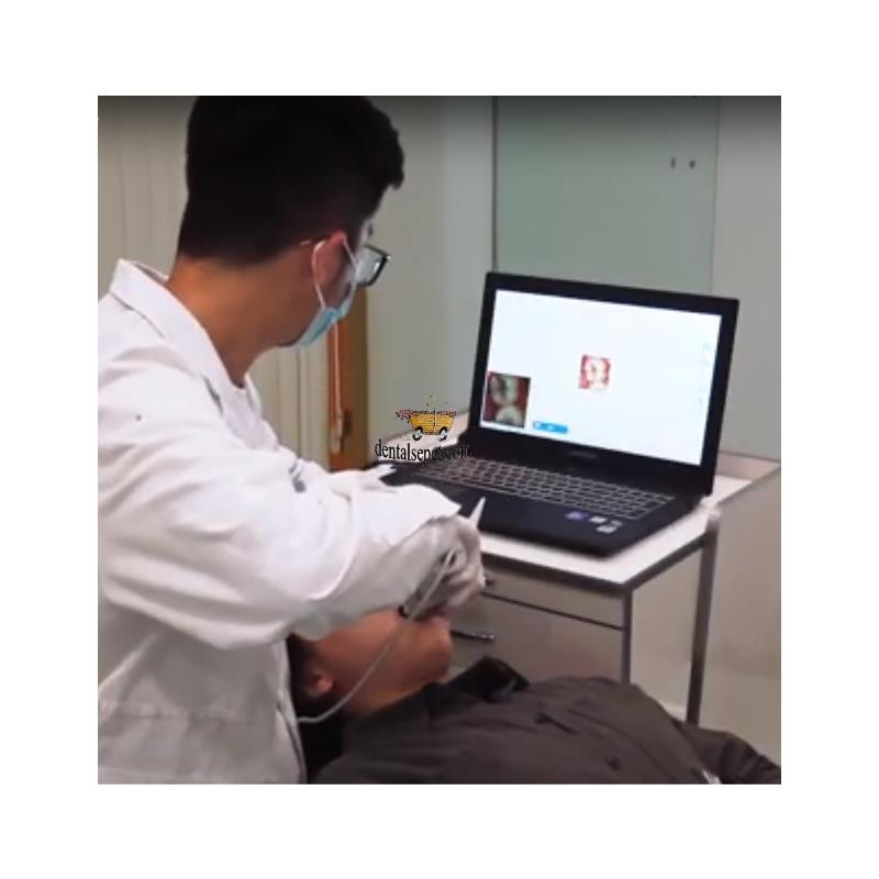 RUNYES 3DS Intraoral Scanner Ağız İçi Tarayıcı « Dentalsepet.com