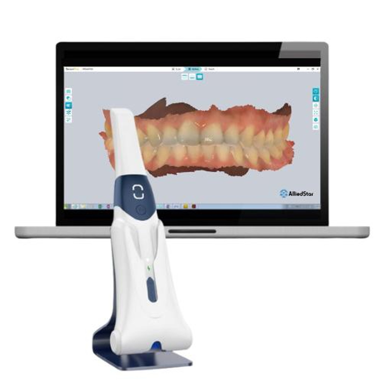 ALLIED STAR - AS 260 - Ağız İçi Tarayıcı « Dentalsepet.com