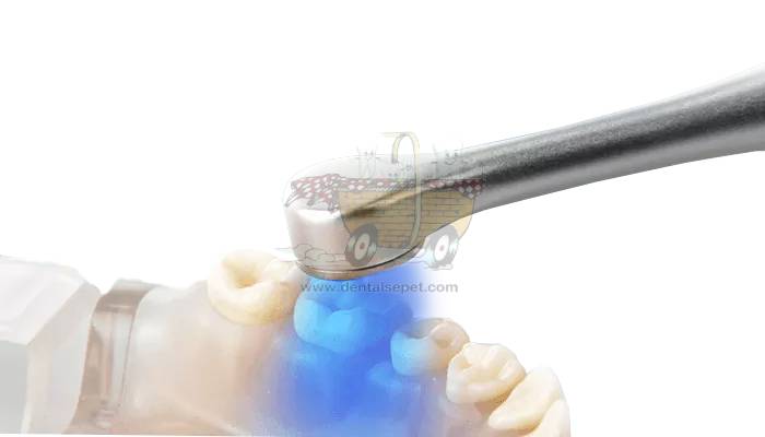 DENCO Işık Cihazı LED Curing Light - IQ8 « Dentalsepet.com