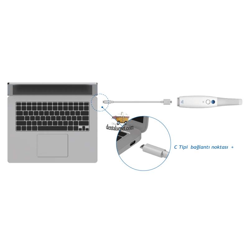 MEDIT i700 Wireless Ağız içi Tarayıcı « Dentalsepet.com