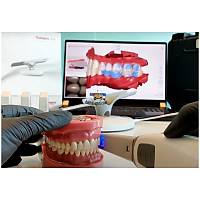 RUNYES 3DS Intraoral Scanner Ağız İçi Tarayıcı « Dentalsepet.com