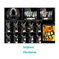 PLANMECA ProMax 3D Mid Tomografi Cihazı « Dentalsepet.com