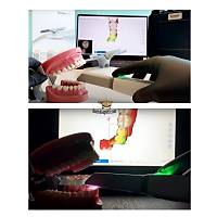 RUNYES 3DS Intraoral Scanner Ağız İçi Tarayıcı « Dentalsepet.com