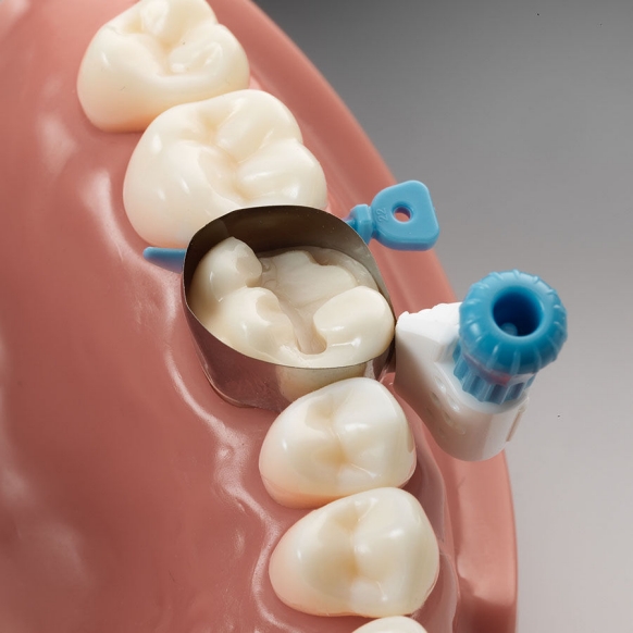 Dentsply Palodent 360 Çevresel Matrix Sistemi İntro Kit